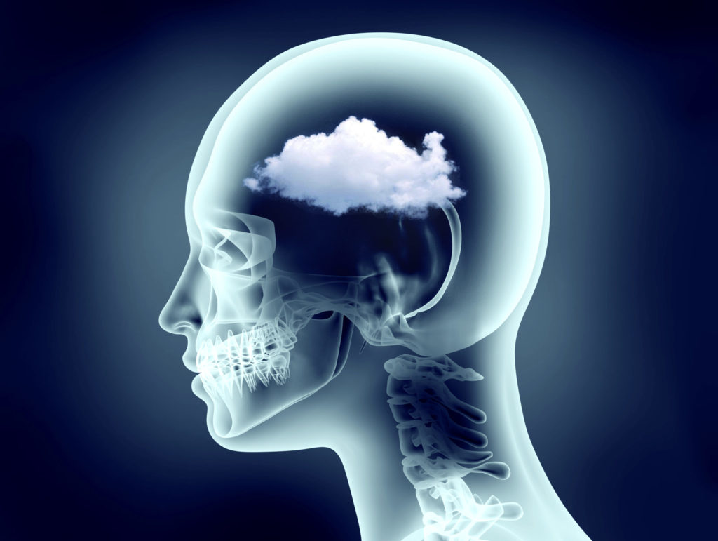 Brain Fog and Chronic Pain | Texas Partners Healthcare Group