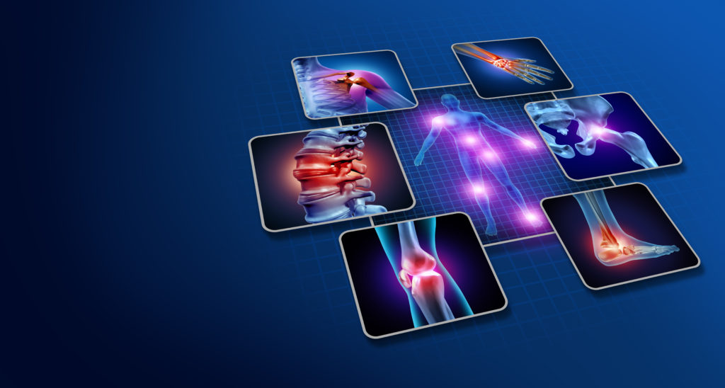 Understanding Arthritis - Texas Partners Healthcare Group Understanding Arthritis - Texas Partners Healthcare Group